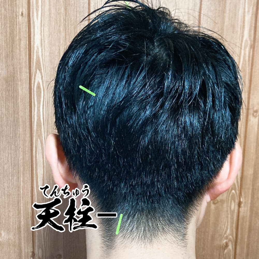 天柱(てんちゅう)[BL10] - TSUBOLAB® [ ツボラボ® ]