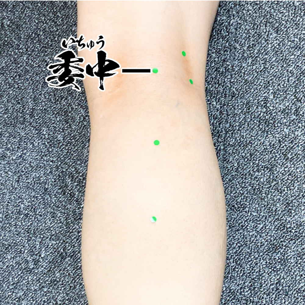 委中(いちゅう)[BL40] - TSUBOLAB® [ ツボラボ® ]