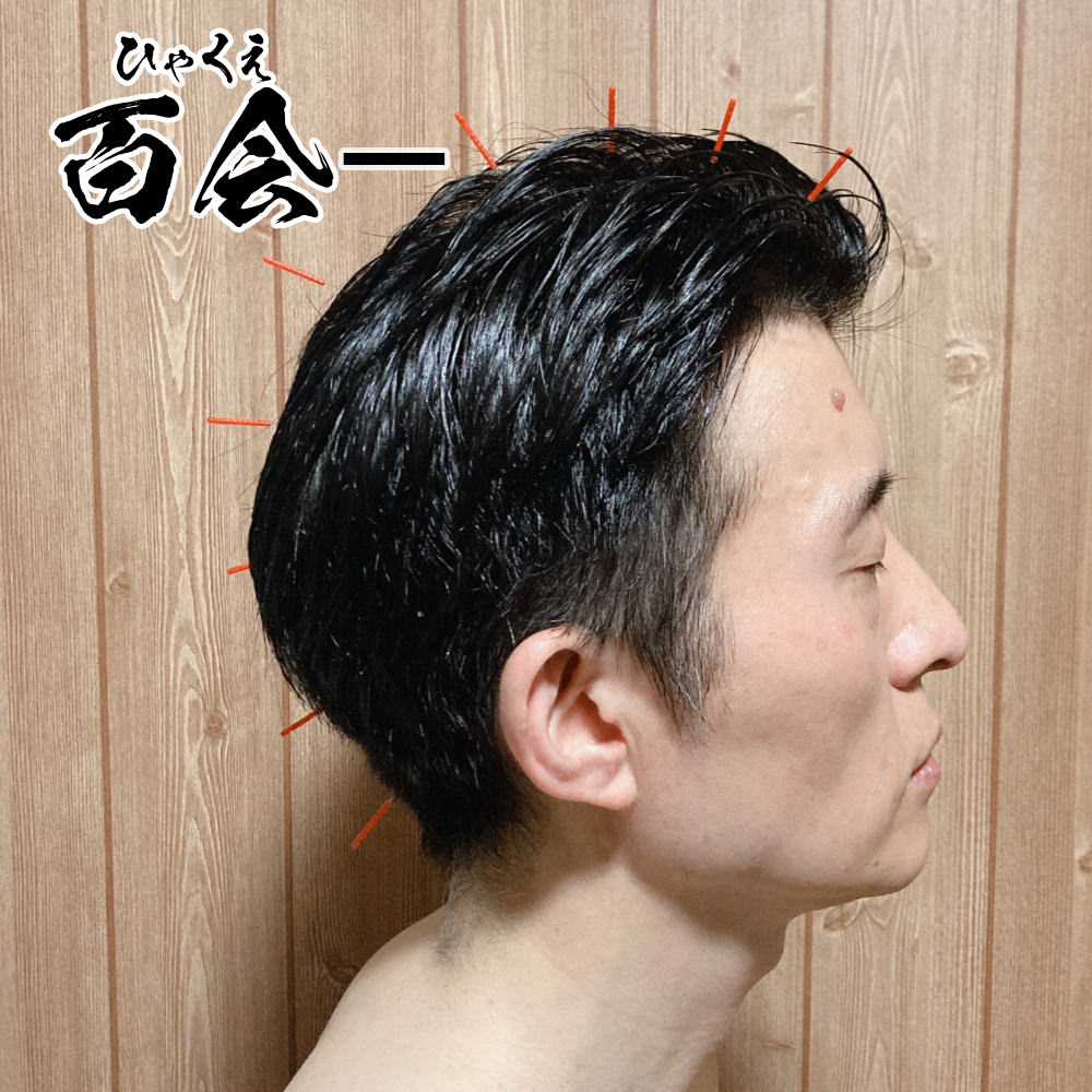 百会(ひゃくえ)[GV20] - TSUBOLAB® [ ツボラボ® ]
