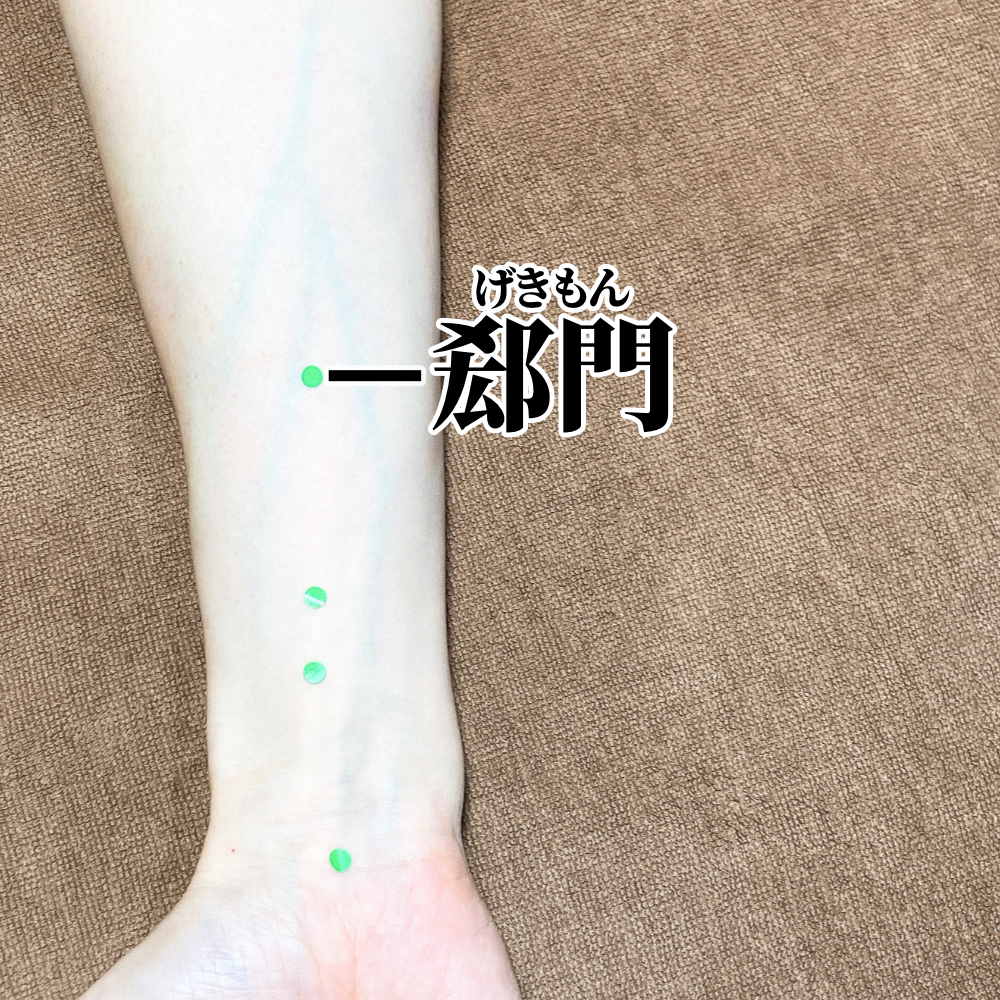 郄門(げきもん)[PC4] - TSUBOLAB® [ ツボラボ® ]