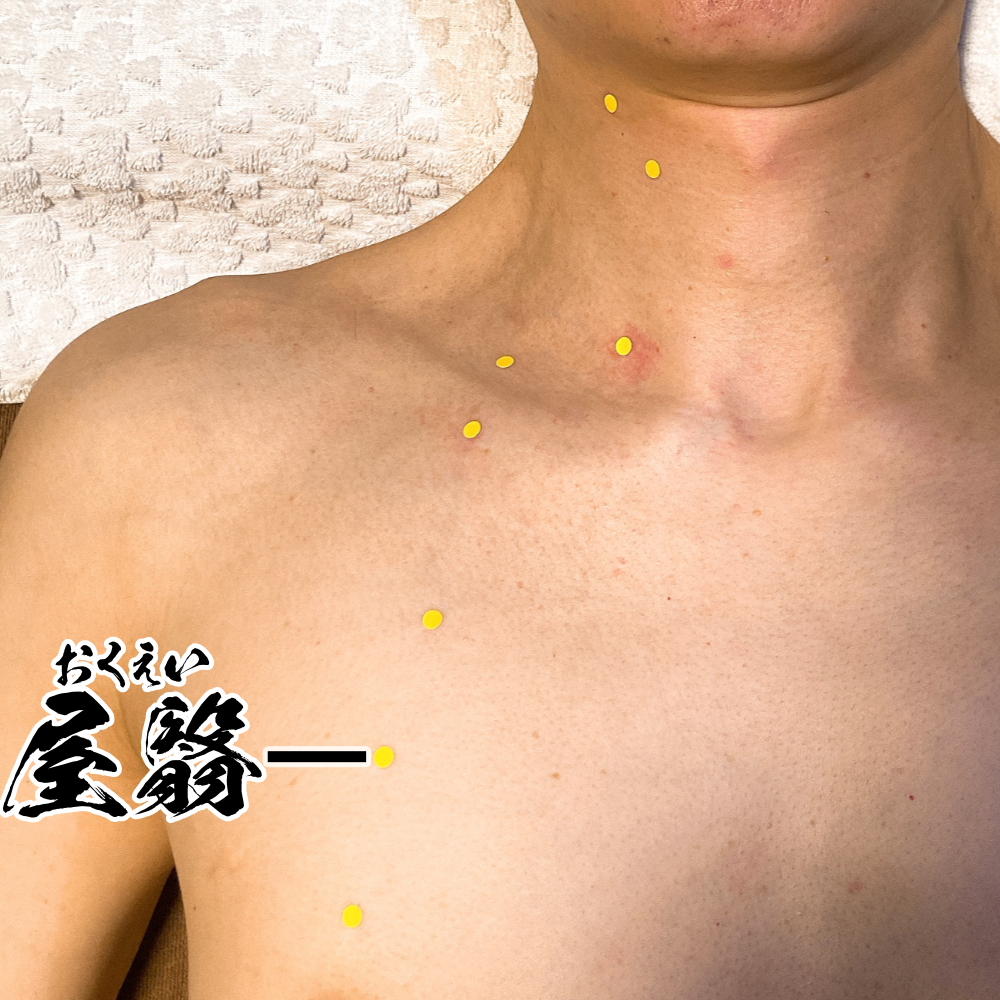 屋翳(おくえい)[ST15] - TSUBO LAB[ツボラボ]