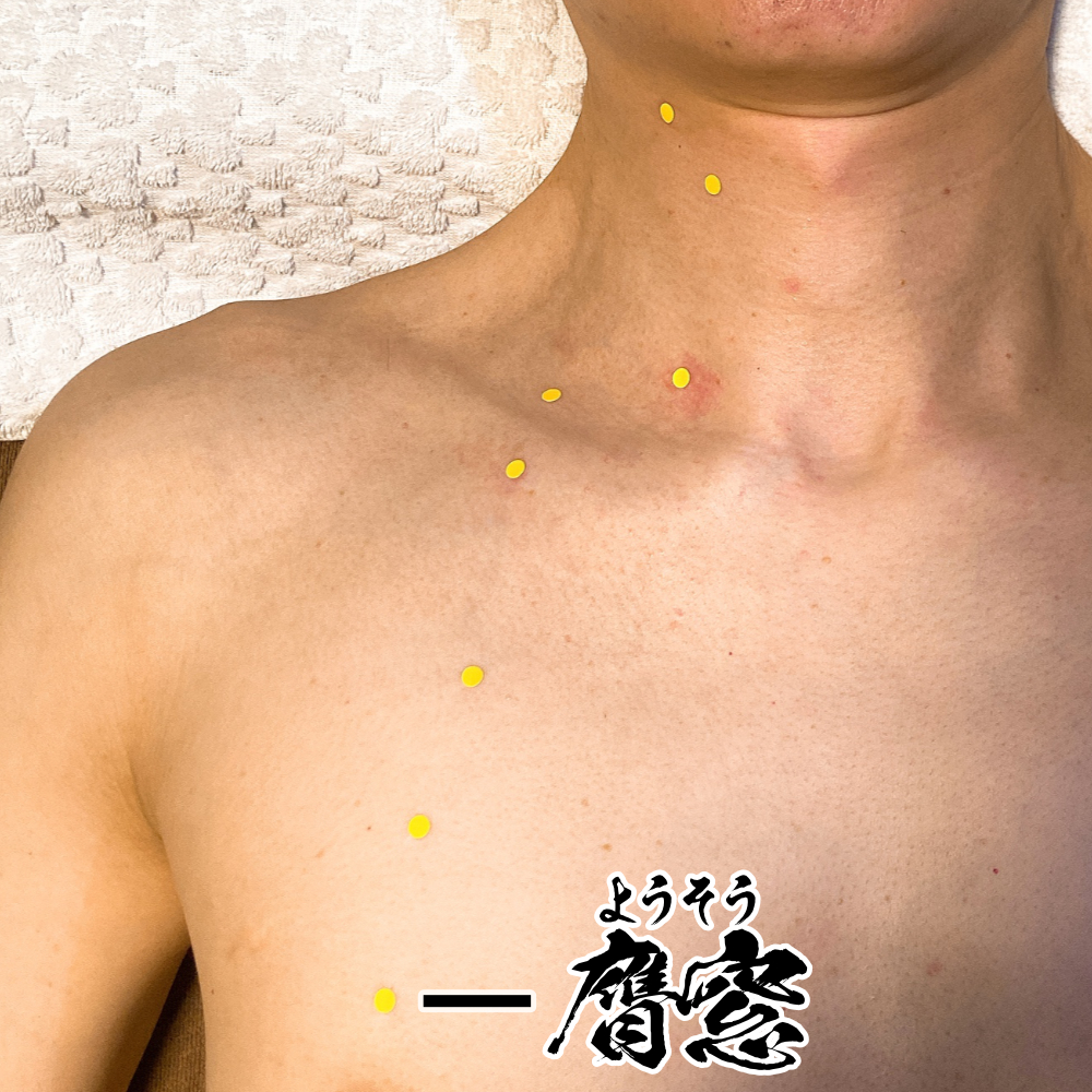 膺窓(ようそう)[ST16] - TSUBOLAB® [ ツボラボ® ]