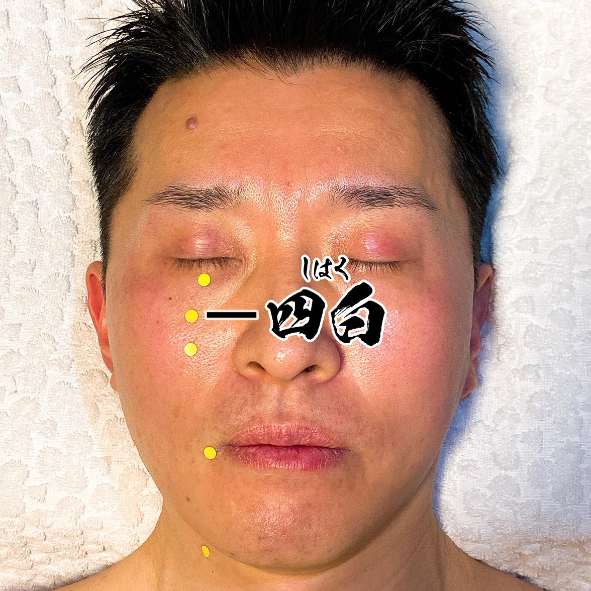 四白(しはく)[ST2] - TSUBOLAB® [ ツボラボ® ]