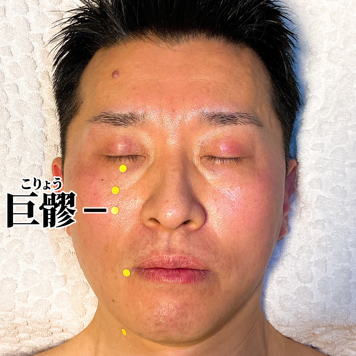 巨髎(こりょう)[ST3] - TSUBOLAB® [ ツボラボ® ]