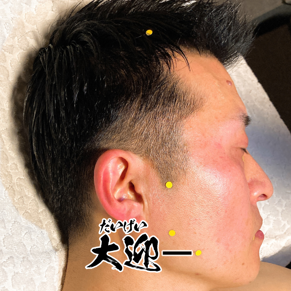 大迎(だいげい)[ST5] - TSUBOLAB® [ ツボラボ® ]